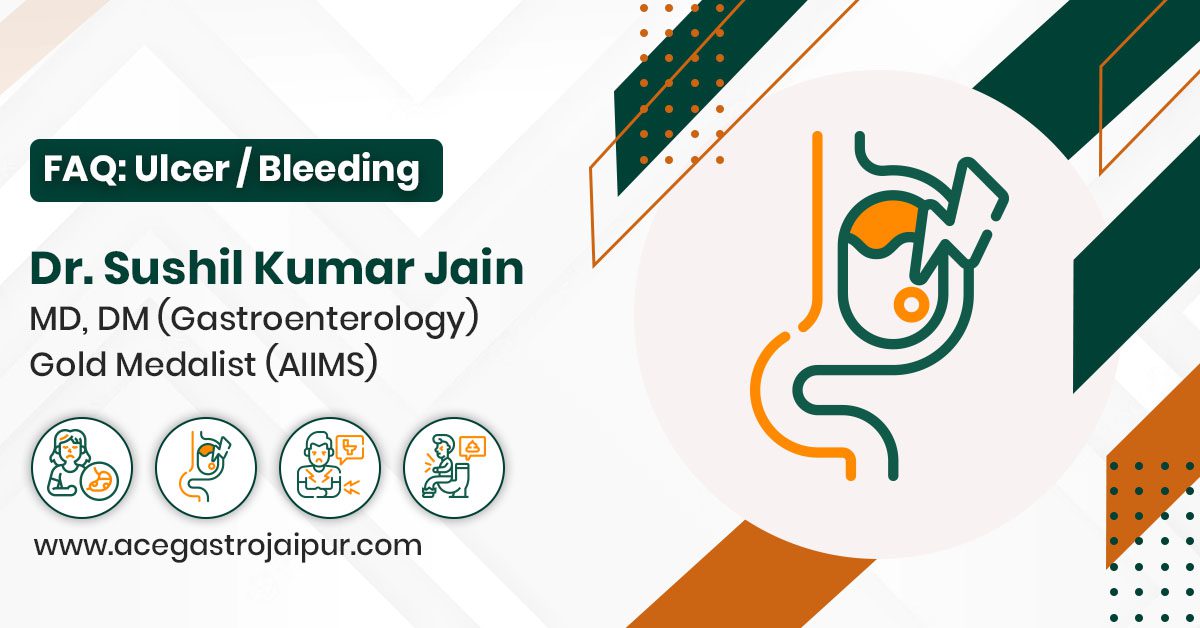 FAQ of Ulcer / Bleeding By Dr. Sushil Kumar Jain | ACE Gastro